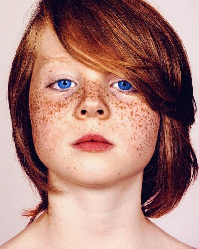 #Freckles - Unique Portrait Series Showing Beauty Of Freckled ...